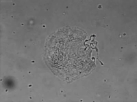 Platelets GIFs - Get the best gif on GIFER