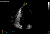 Echocardiography GIFs - Get the best gif on GIFER