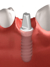 Tooth GIFs - Get the best gif on GIFER