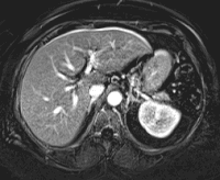 Resonance GIFs - Get the best gif on GIFER