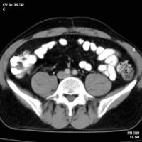 Slit scan GIFs - Get the best gif on GIFER