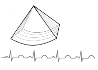 Ultrasound GIFs - Get the best gif on GIFER