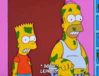 Leprosy GIFs - Get the best gif on GIFER
