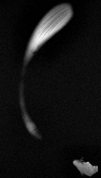 Mri GIFs - Get the best gif on GIFER