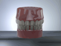 Tooth GIFs - Get the best gif on GIFER