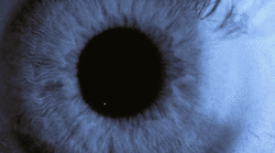 Dilating гифки, анимированные GIF изображения dilating - скачать гиф ...