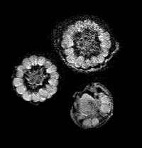 Mri GIFs - Get the best gif on GIFER