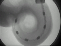 Operation GIFs - Get the best gif on GIFER