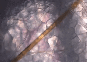 Skin cells GIF - Conseguir el mejor gif en GIFER