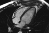 Resonance GIFs - Get the best gif on GIFER