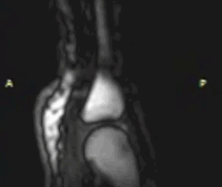 Mrt GIFs - Get the best gif on GIFER