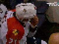 Pulling teeth GIFs - Get the best gif on GIFER