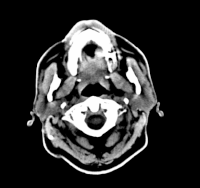 Mri scan GIFs - Get the best gif on GIFER