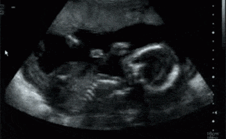 Sickened GIFs - Get the best gif on GIFER