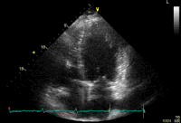 Ultrasound GIFs - Get the best gif on GIFER