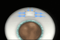 Cirurgia GIF - Conseguir o melhor gif em GIFER