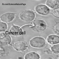 Cancer GIFs - Get the best gif on GIFER