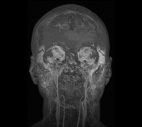 Mri GIFs - Get the best gif on GIFER
