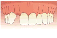 Tooth extraction GIFs - Get the best gif on GIFER
