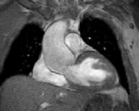 Mrt GIFs - Get the best gif on GIFER