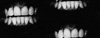 Teeth GIFs - Get the best gif on GIFER