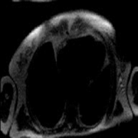 Resonance GIFs - Get the best gif on GIFER