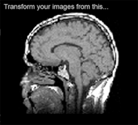 Mri GIFs - Get the best gif on GIFER