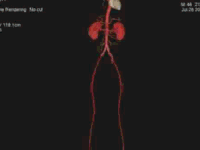 Ct GIFs - Get the best gif on GIFER