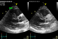 Ultrasound GIFs - Get the best gif on GIFER