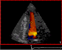 Echocardiography GIFs - Get the best gif on GIFER