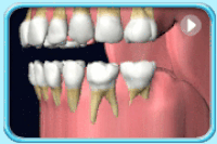 Tooth GIFs - Get the best gif on GIFER