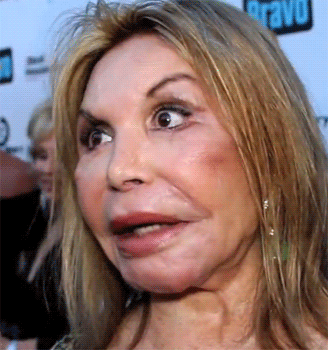 Botox GIFs - Get the best gif on GIFER