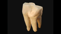 Tooth GIFs - Get the best gif on GIFER