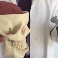 Concussions GIFs - Get the best gif on GIFER