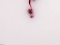 Bleeding GIFs - Get the best gif on GIFER