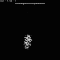 Mri GIFs - Get the best gif on GIFER