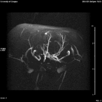 Neuroscience GIFs - Get the best gif on GIFER