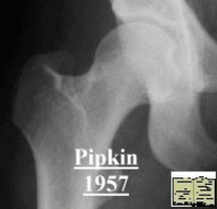 Fracture GIFs - Obtenez le meilleur gif sur GIFER