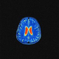 Brain GIFs - Get the best gif on GIFER