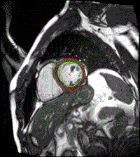 Mri GIFs - Get the best gif on GIFER