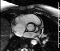 Cardiac GIFs - Get the best gif on GIFER