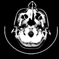 Brain tumor GIFs - Get the best gif on GIFER