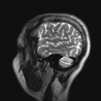 Mri scan GIFs - Get the best gif on GIFER