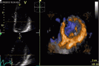 Ultrasound GIFs - Get the best gif on GIFER