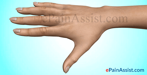 Finger injuries information center GIF - Conseguir el mejor gif en GIFER