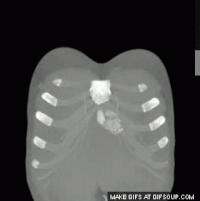 Lungs GIFs - Get the best gif on GIFER