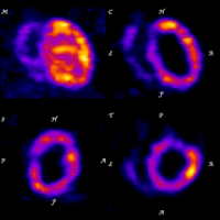 Intensity GIFs - Get the best gif on GIFER