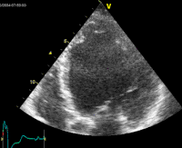 Doppler GIFs - Get the best gif on GIFER