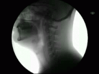 Radiography GIFs - Get the best gif on GIFER