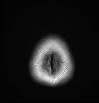 Cancer GIFs - Get the best gif on GIFER